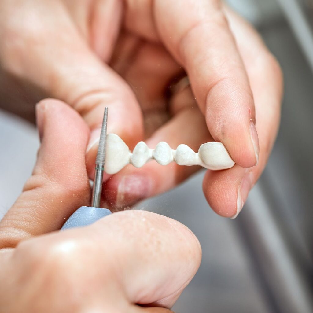 ¿Qué son los puentes dentales? - IPIRO | "A New Level Of Quality"